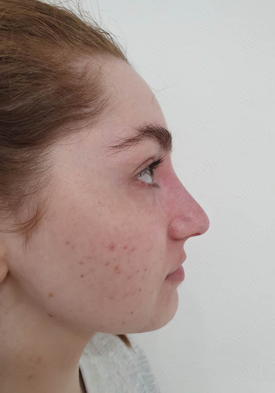 PDO COG Threads - DoctorFace